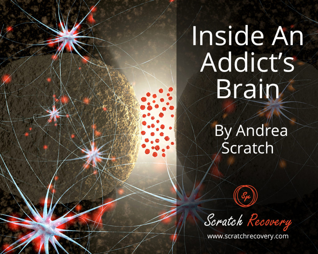 Inside An Addict’s Brain | Scratch Recovery